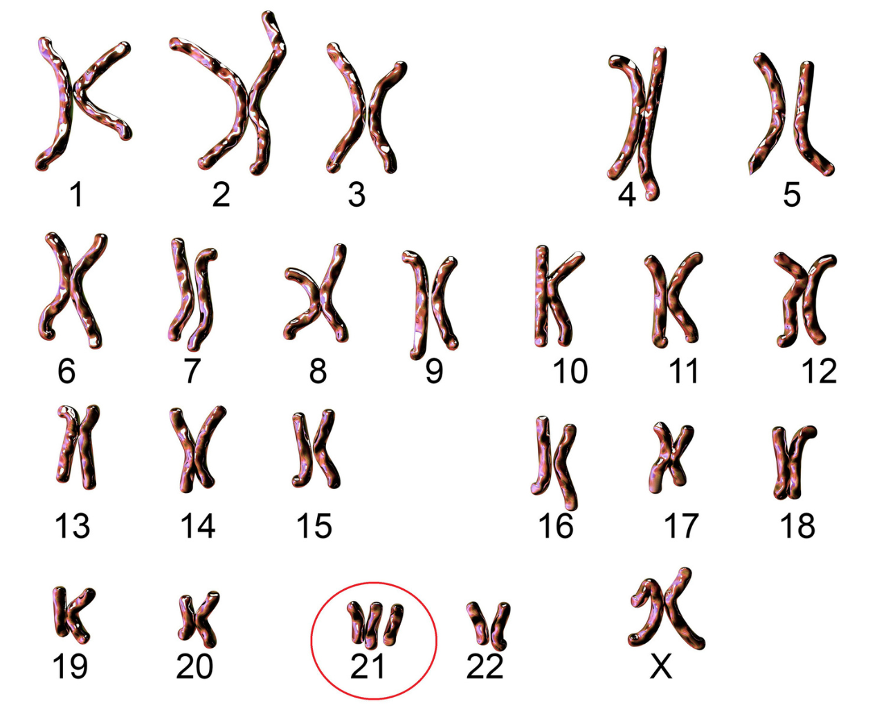5 de mayo Día Mundial del Síndrome Cri du Chat - Box Diario